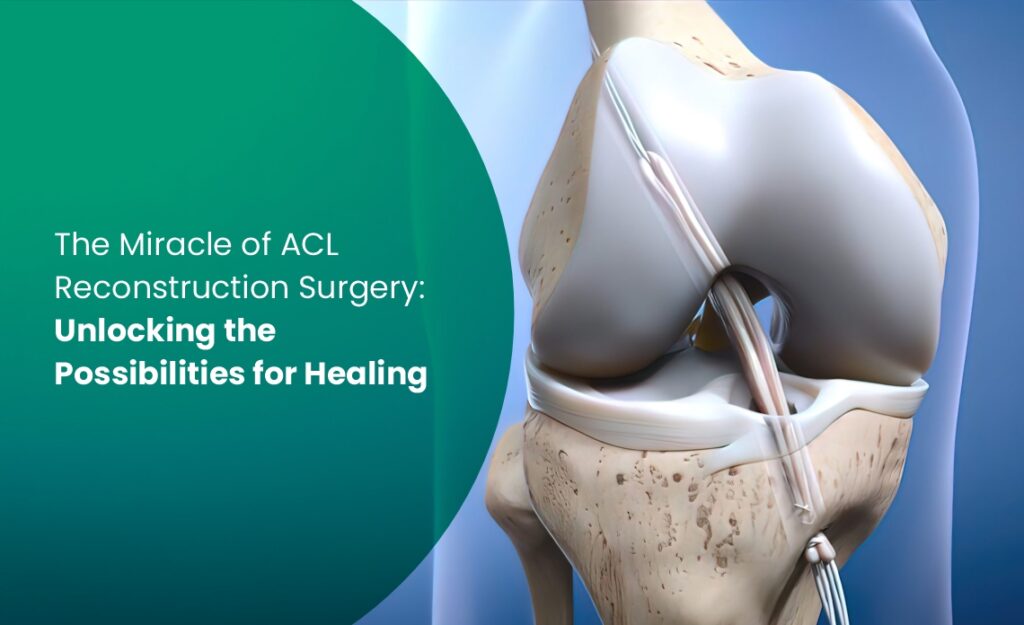 The Miracle of ACL Reconstruction Surgery